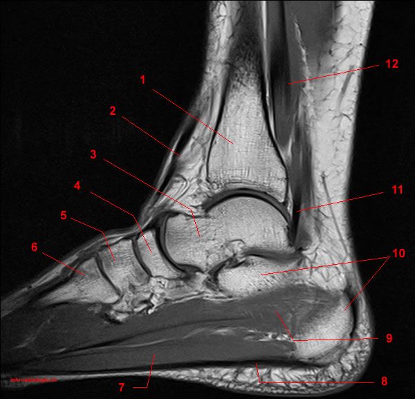 Foot Anatomy Mri Foot Priority Diagnostics