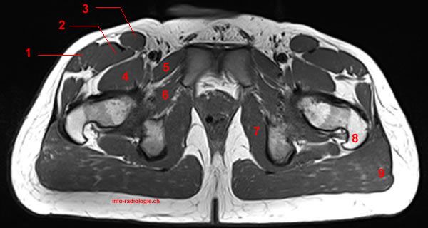 Thigh Mri Anatomy Myositis And Its Mimics: Guideline Updates, MRI