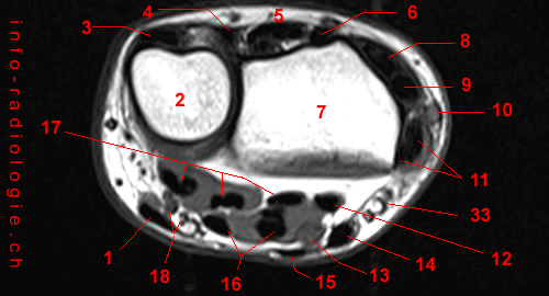 Atlas of Wrist MRI Anatomy - W-Radiology