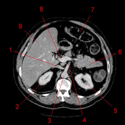 Atlas of CT Anatomy of the Abdomen - W-Radiology