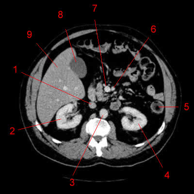 Atlas of CT Anatomy of the Abdomen - W-Radiology