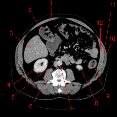 Atlas of CT Anatomy of the Abdomen - W-Radiology