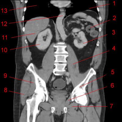 Atlas of CT Anatomy of the Abdomen - W-Radiology