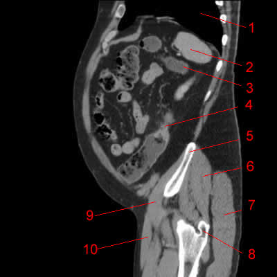 Atlas of CT Anatomy of the Abdomen - W-Radiology