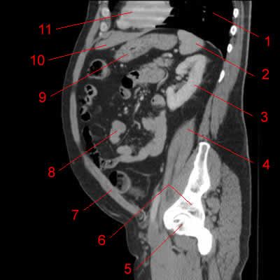 Atlas of CT Anatomy of the Abdomen - W-Radiology
