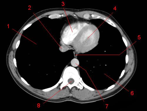 Ct Scan Chest Anatomy Human Chest Anatomy. 3D Computed Tomography (CT)