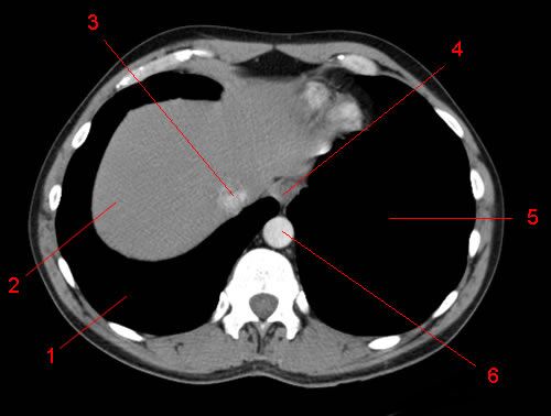 Atlas of CT Anatomy of the Chest - W-Radiology