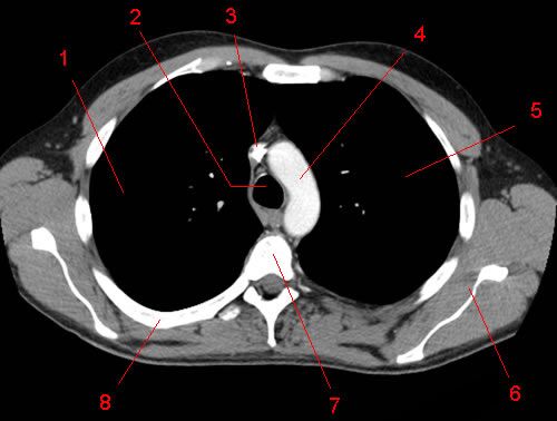Atlas of CT Anatomy of the Chest - W-Radiology