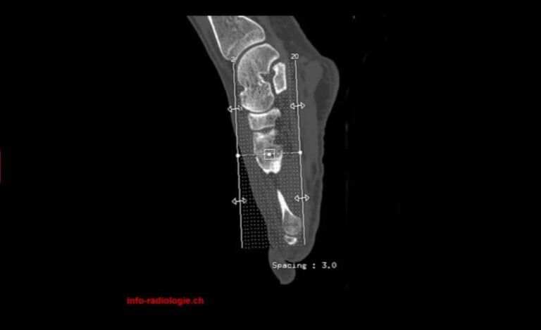 Ankle and foot - W-Radiology