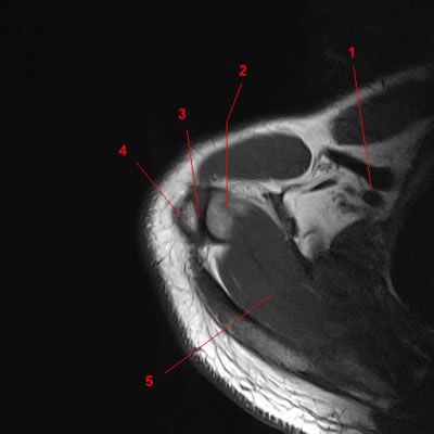 Shoulder Anatomy Mri