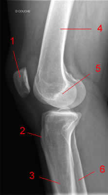 Knee radiograph - W-Radiology
