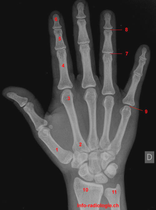 Hand radiography - W-Radiology