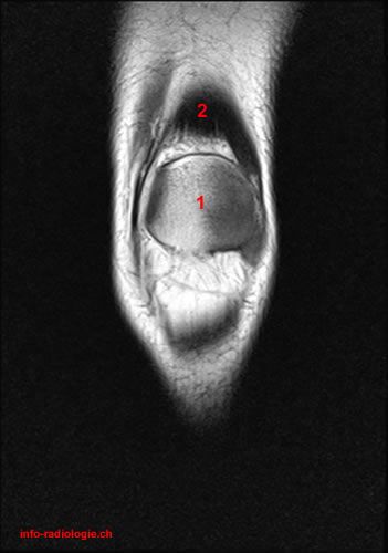mri master knee coronal