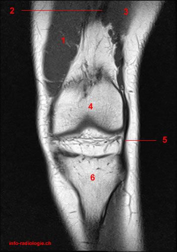 normal mri knee