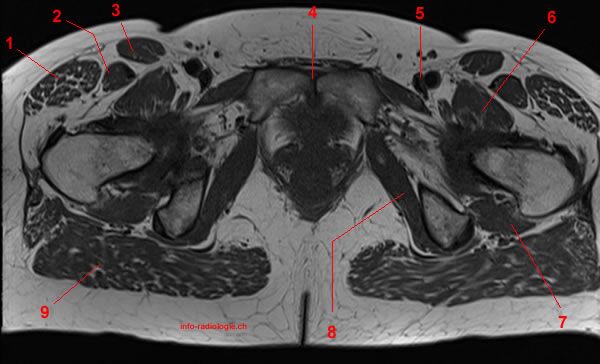MRI of the Hip: Detailed Anatomy - W-Radiology