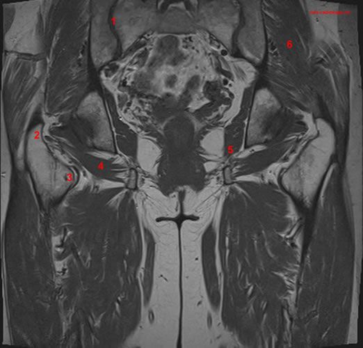 MRI of the Hip: Detailed Anatomy - W-Radiology