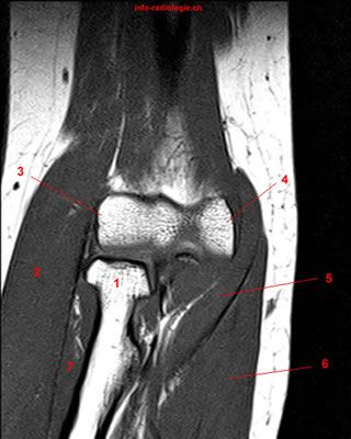MRI of the Elbow: Detailed Anatomy - W-Radiology