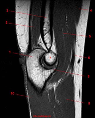 Elbow Anatomy Muscles Mri