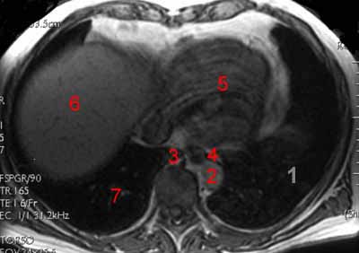 Atlas MRI Abdomen - W-Radiology